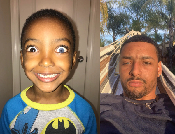 People embracing their genetic abnormalities are beautiful