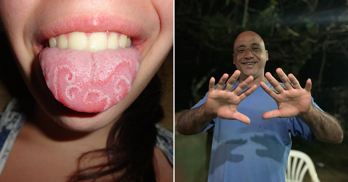 People embracing their genetic abnormalities are beautiful