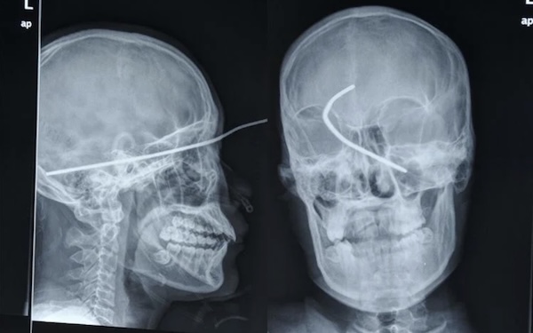 Strange and Bizarre X-Rays that fracture logic itself