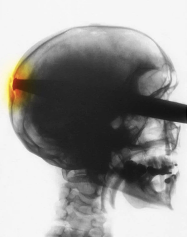 Strange and Bizarre X-Rays that fracture logic itself
