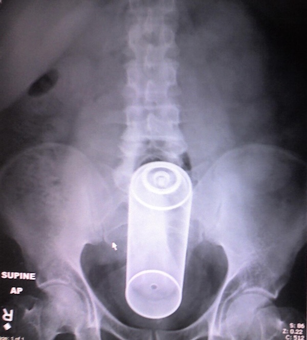 Strange and Bizarre X-Rays that fracture logic itself