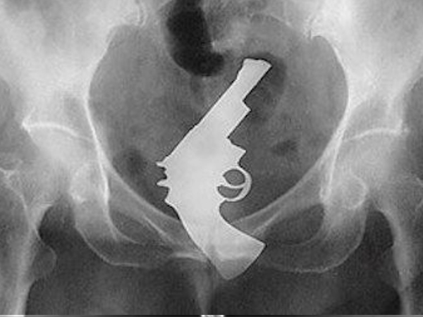 Strange and Bizarre X-Rays that fracture logic itself